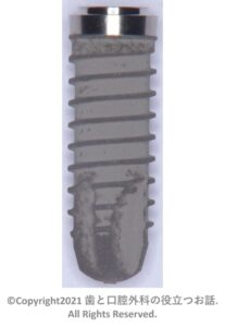 SPI ELEMENT Implant | 歯と口腔外科の役立つお話