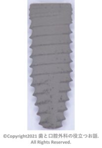 CONELOG PROGRESSIVE-LINE Implant について | 歯と口腔外科の役立つお話